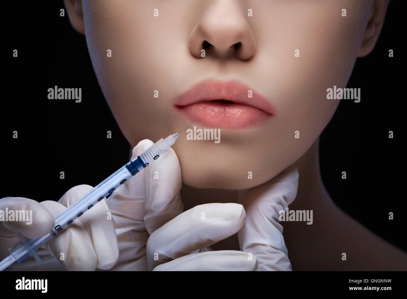 Detailled close up view of a lip injection Stock Photo - Alamy