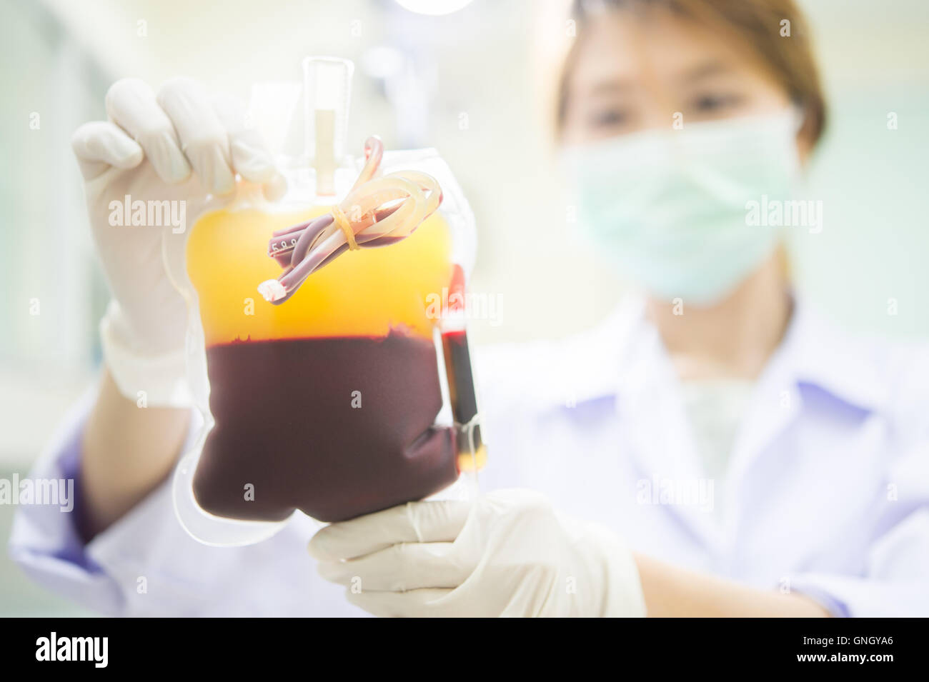 Bag of Blood in hand asian woman Doctor Stock Photo - Alamy