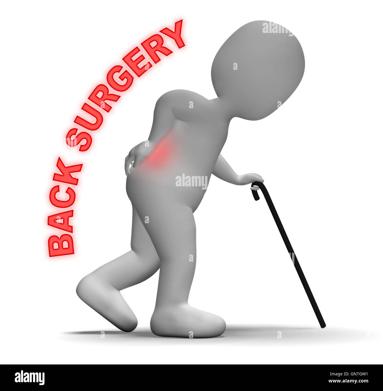 Spinal surgery Cut Out Stock Images & Pictures - Alamy