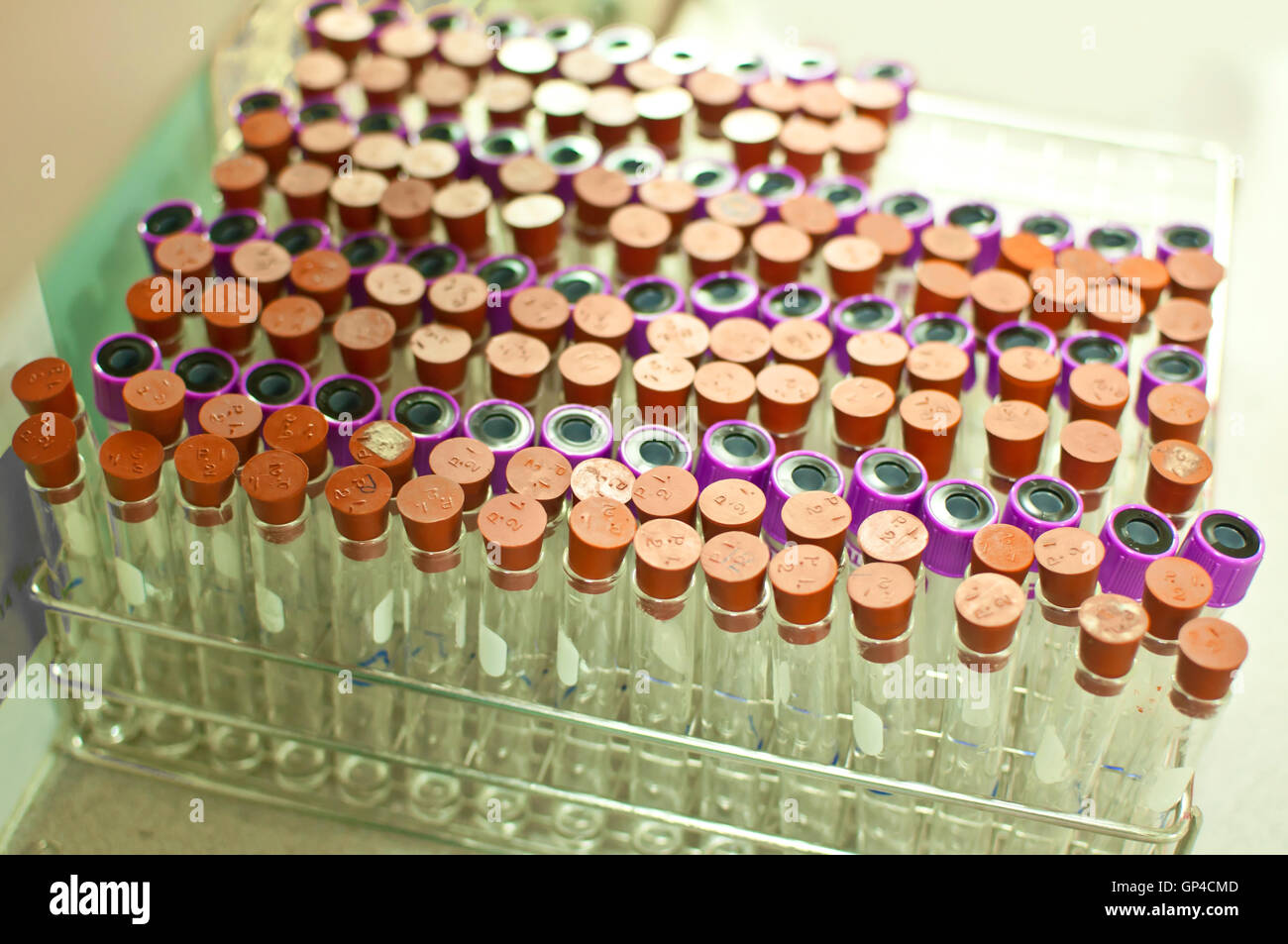 Blood group test hi-res stock photography and images - Alamy