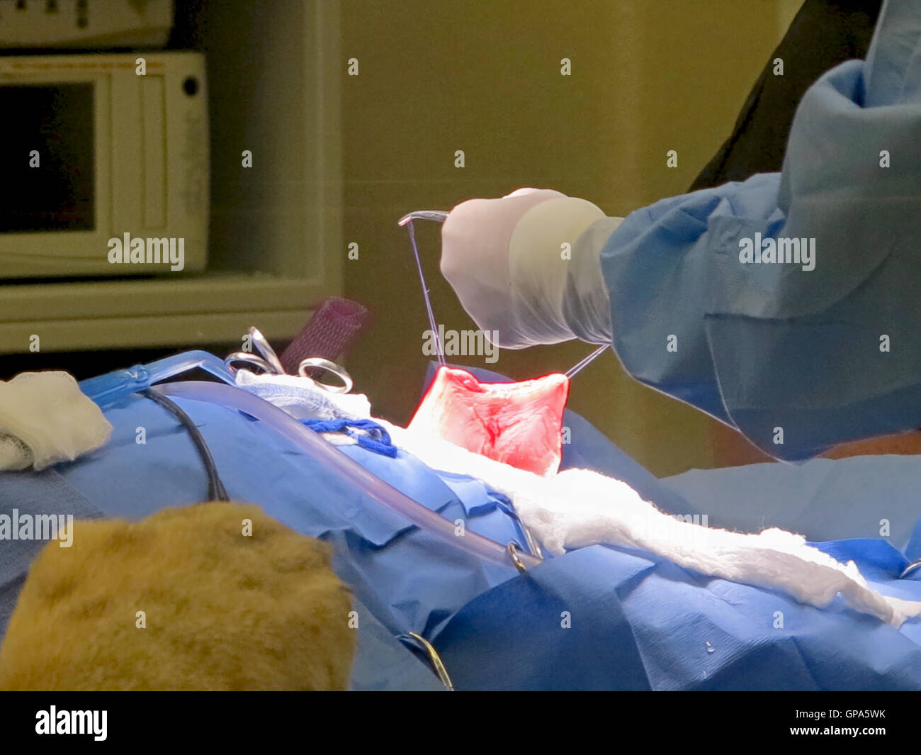 Stomach stitches hi-res stock photography and images - Alamy
