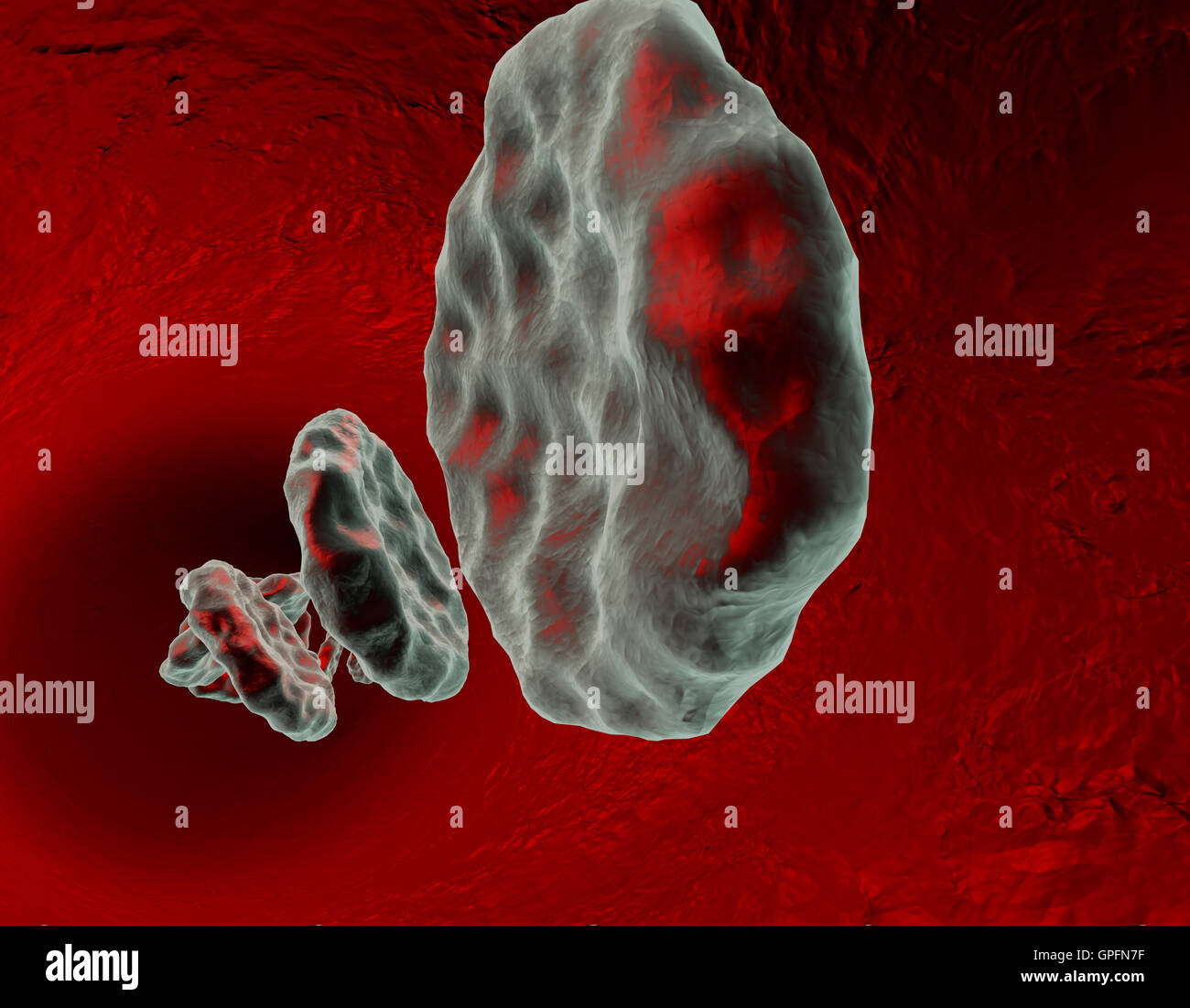 Infected blood vein Stock Photo - Alamy