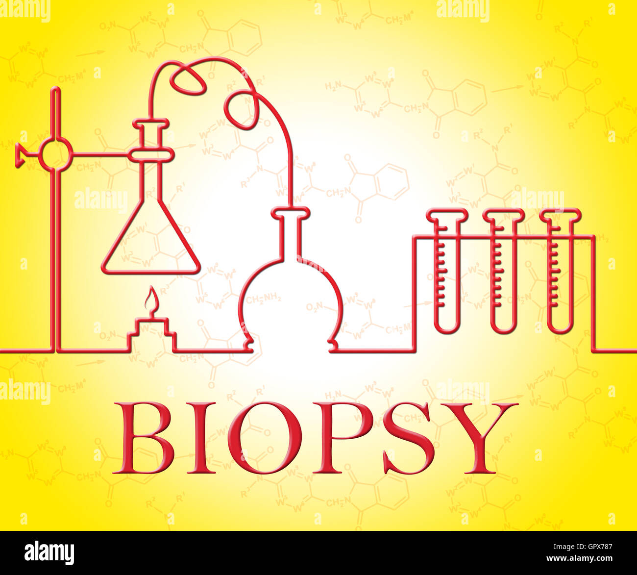 Biopsy hi-res stock photography and images - Alamy