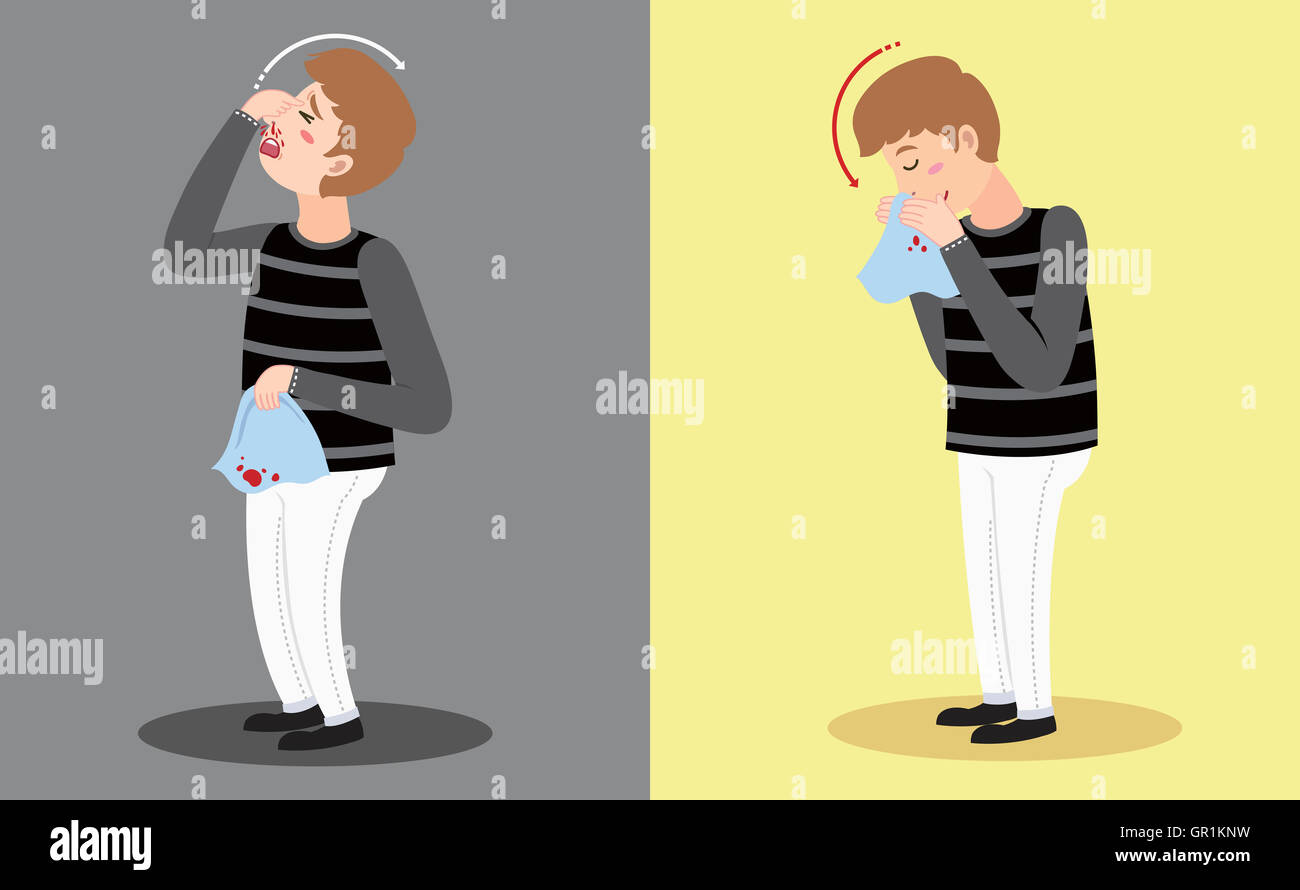 Man bleeding at nose Stock Photo - Alamy