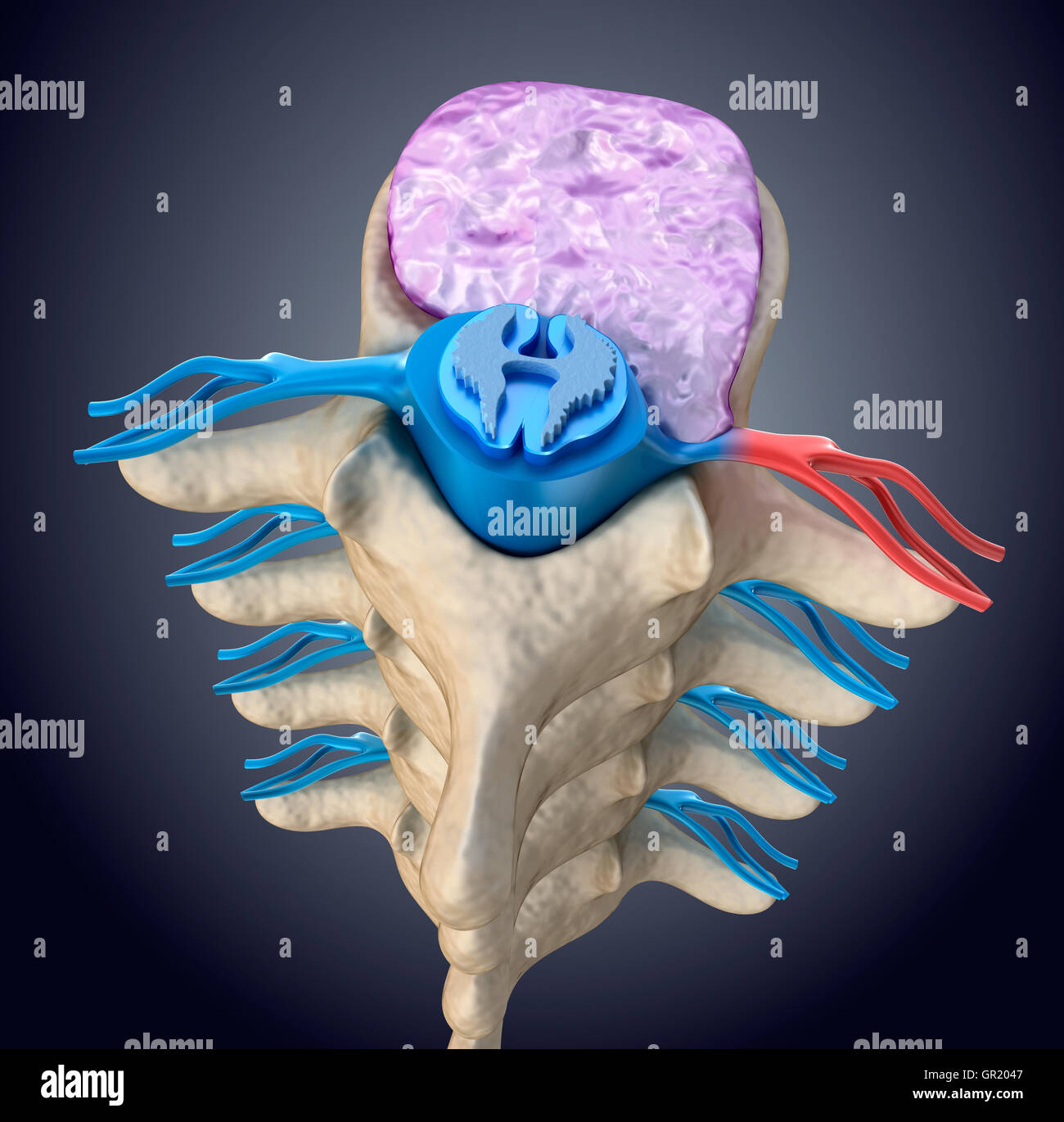 Disc extrusion hi-res stock photography and images - Alamy