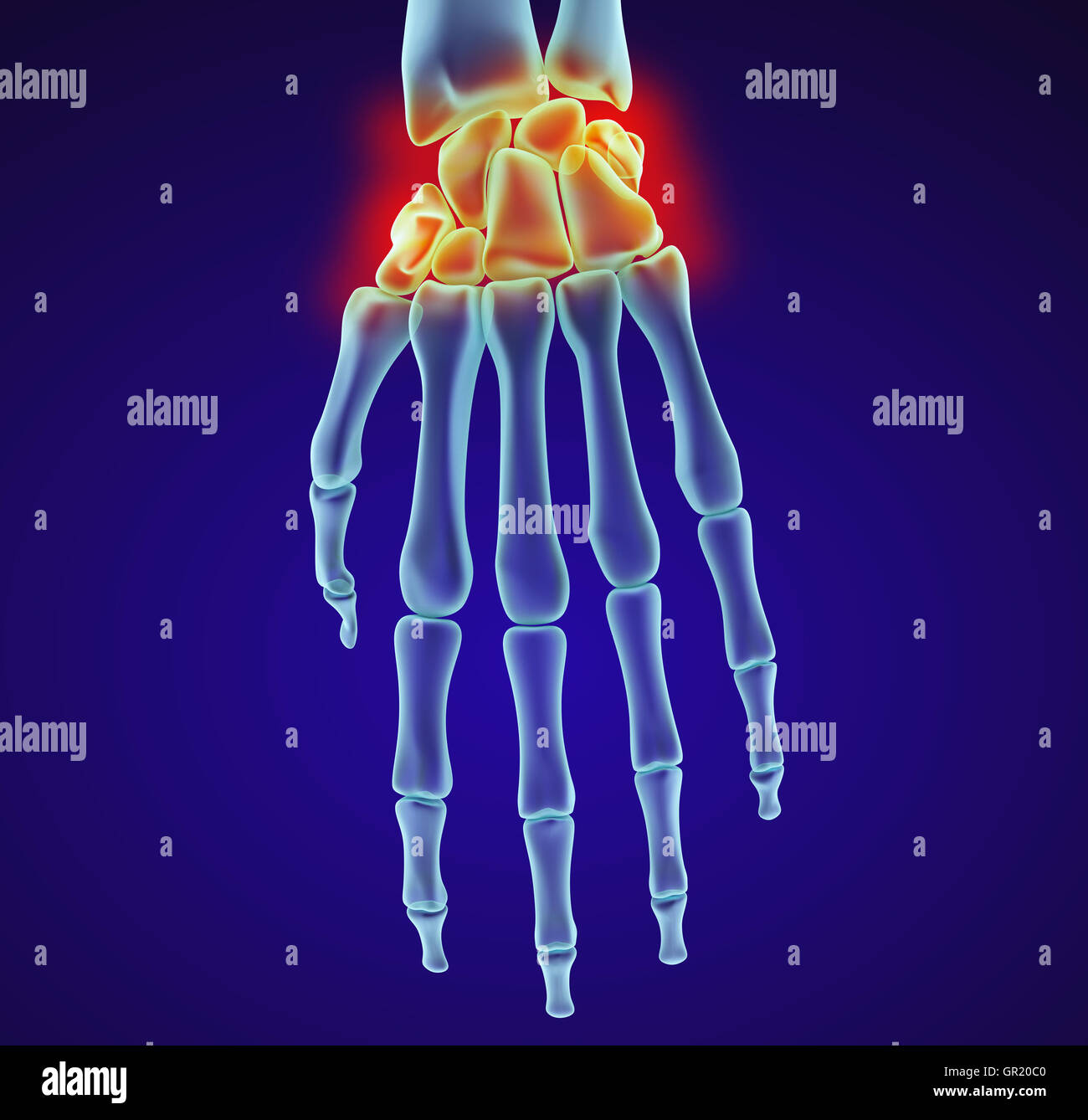 Human wrist anatomy xray view hi-res stock photography and images - Alamy