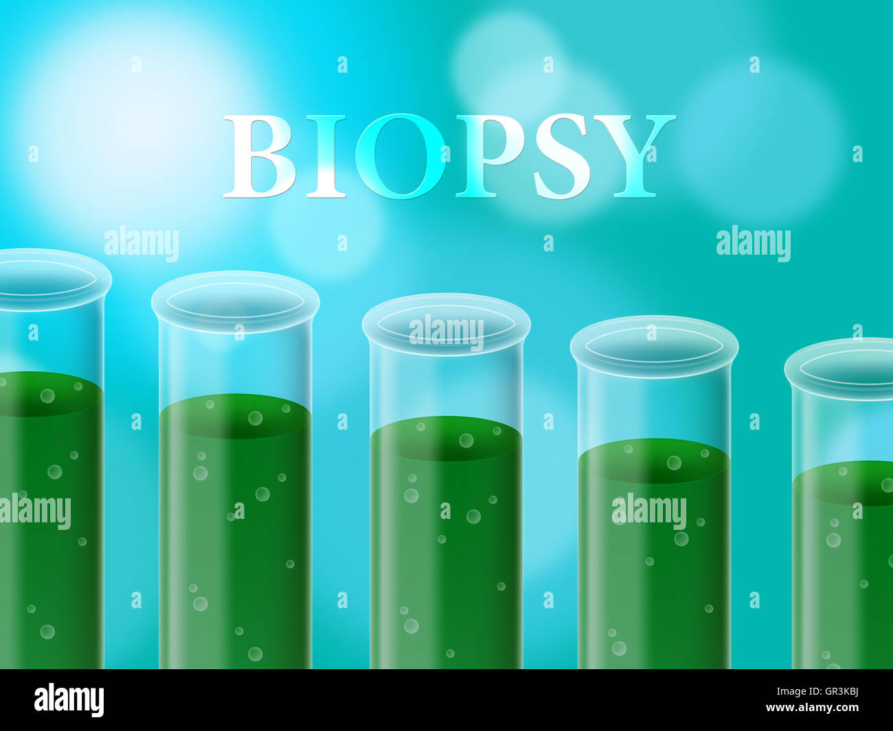 Biopsy hi-res stock photography and images - Alamy