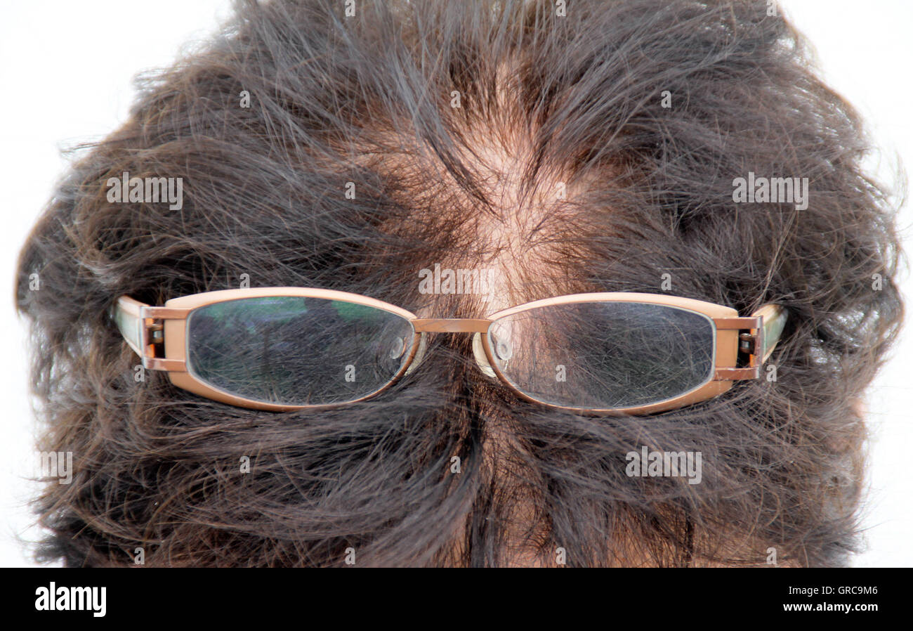 Falling Out Of Hair Stock Photo - Alamy