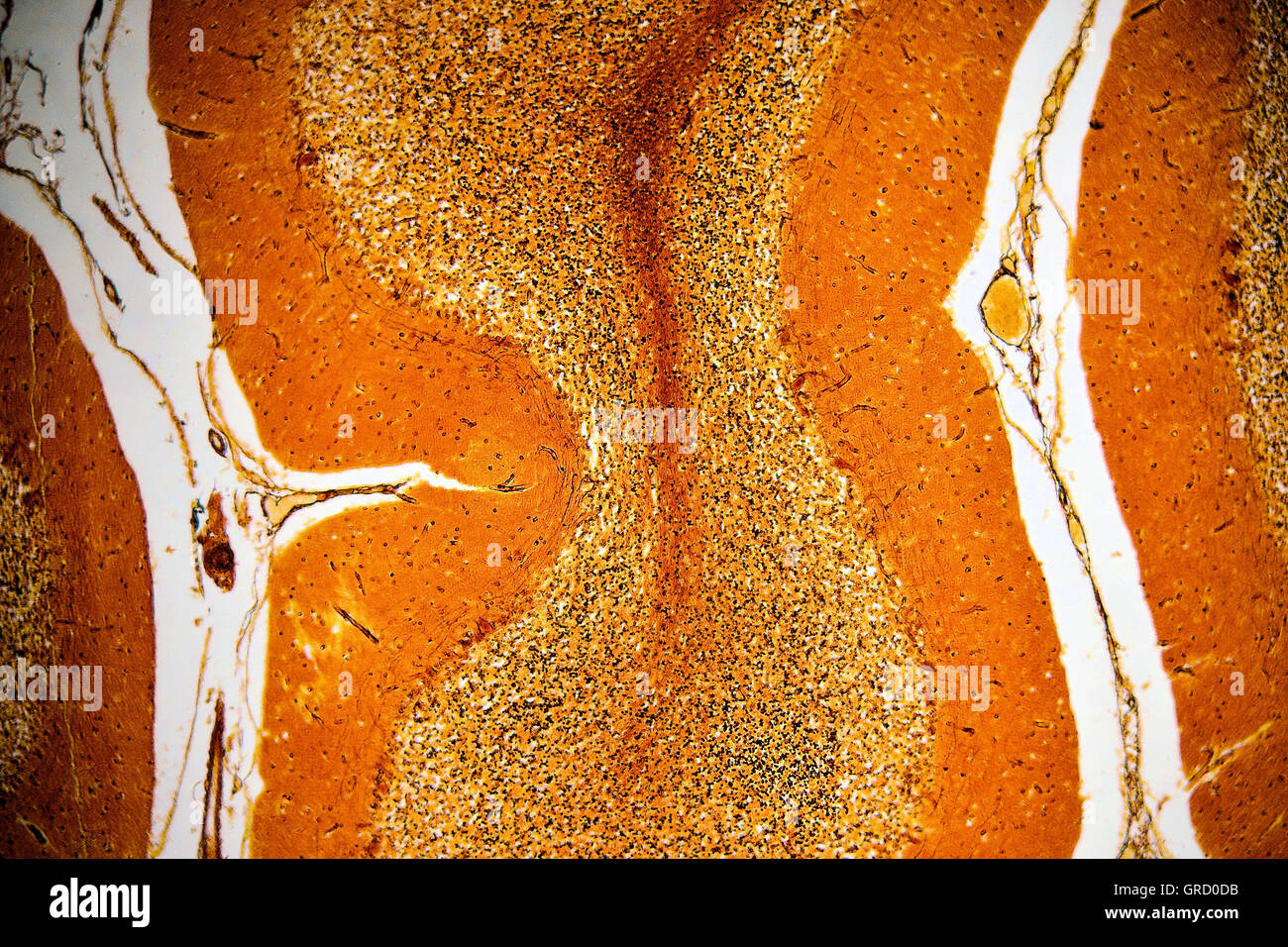 Human Cerebellum Histoligical Slide Stock Photo - Alamy