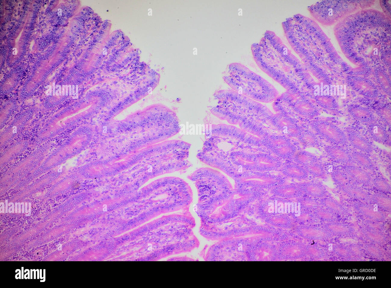 Intestinal wall hi-res stock photography and images - Alamy