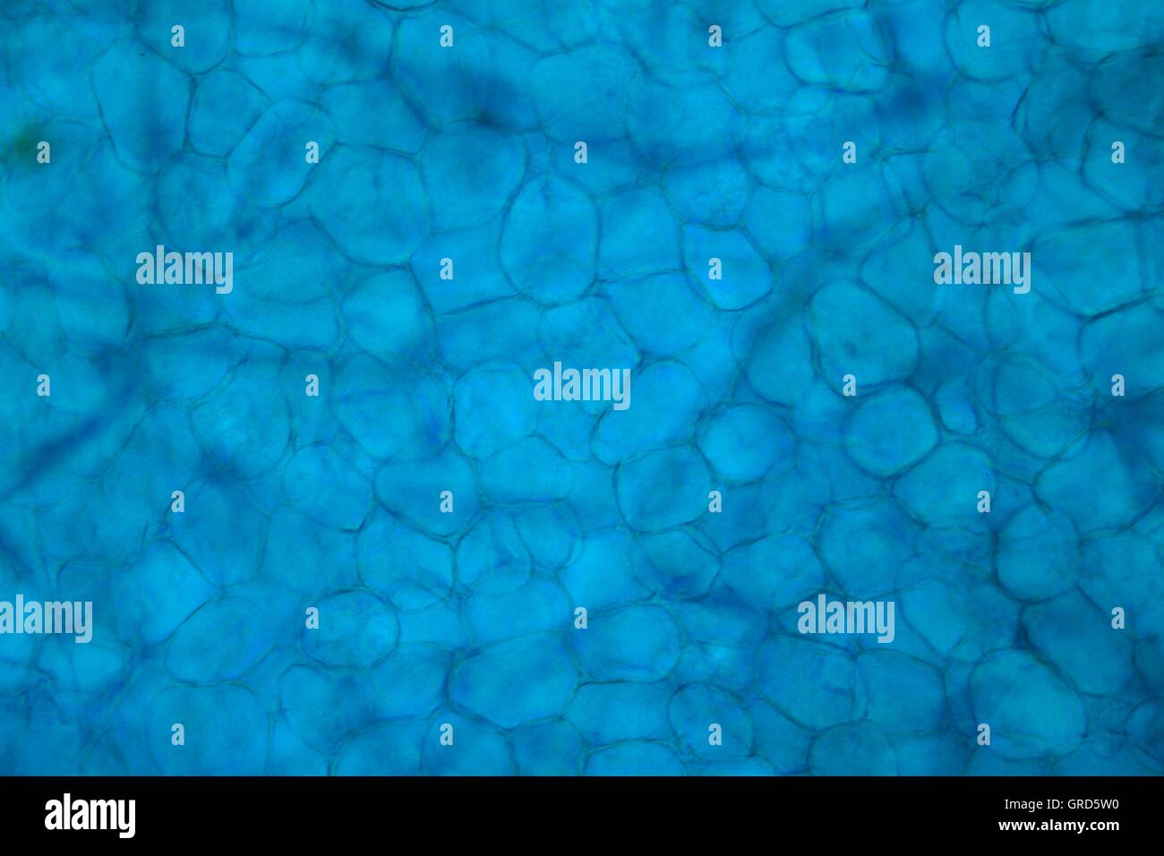 Microscopic Preparation Of Fatty Tissue With Fat Cells. 400 X ...