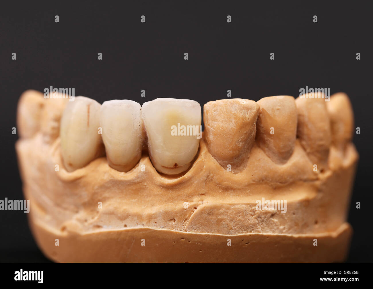 Dental Impression High Resolution Stock Photography and Images - Alamy