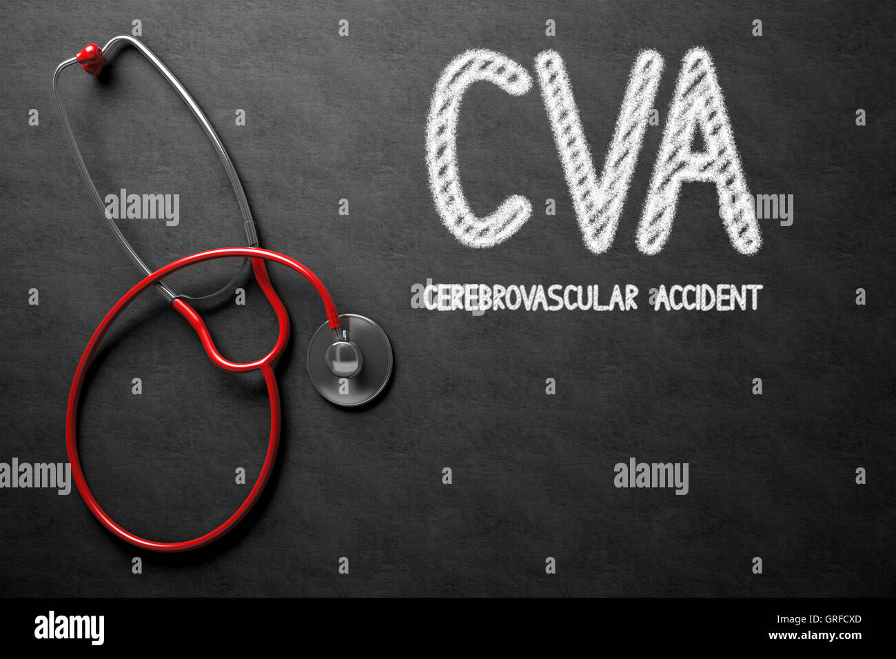 Cerebrovascular accident stroke hi-res stock photography and images - Alamy