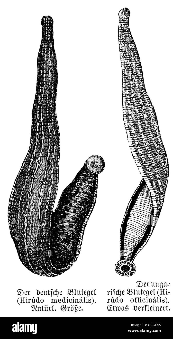 Leeches medicine hi-res stock photography and images - Alamy