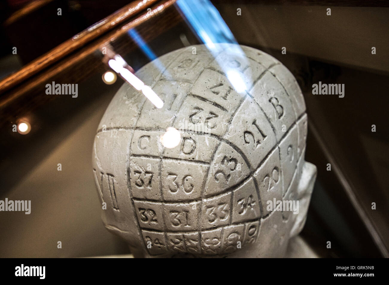 Human anatomy disorders hi-res stock photography and images - Alamy