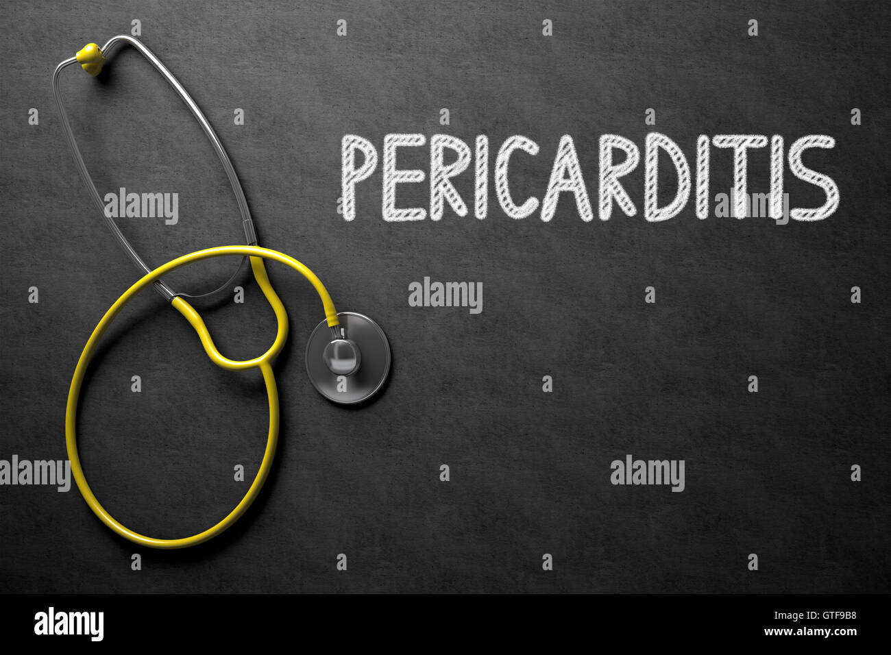 Pericarditis - Text on Chalkboard. 3D Illustration Stock Photo - Alamy