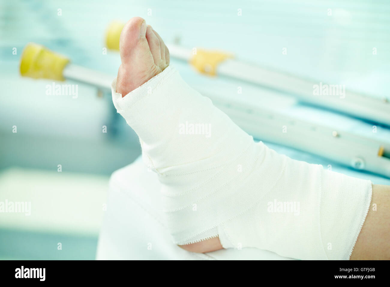Fractured leg hospital hi-res stock photography and images - Alamy
