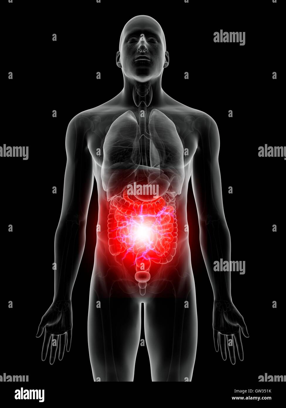 Human stomach pain, illustration Stock Photo - Alamy