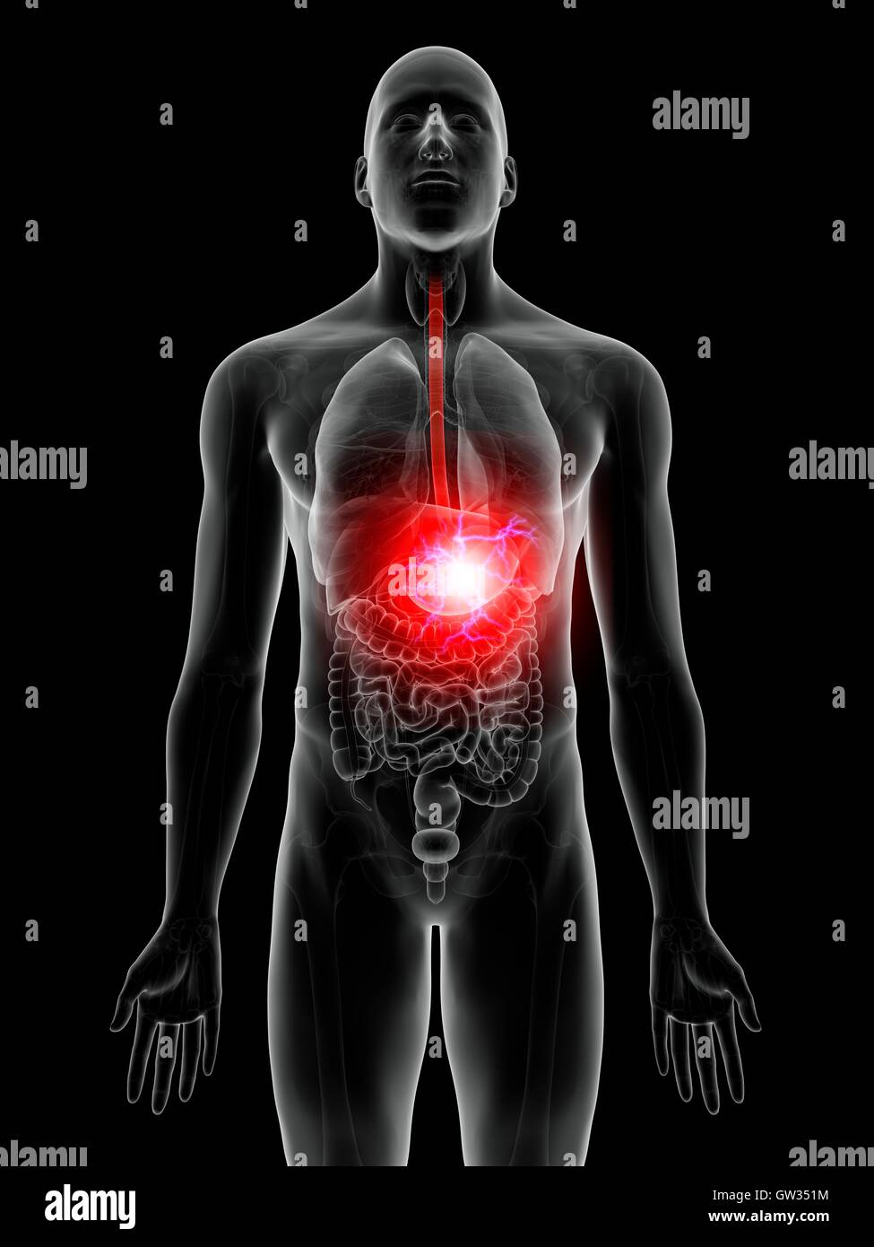 Human stomach pain, illustration Stock Photo - Alamy