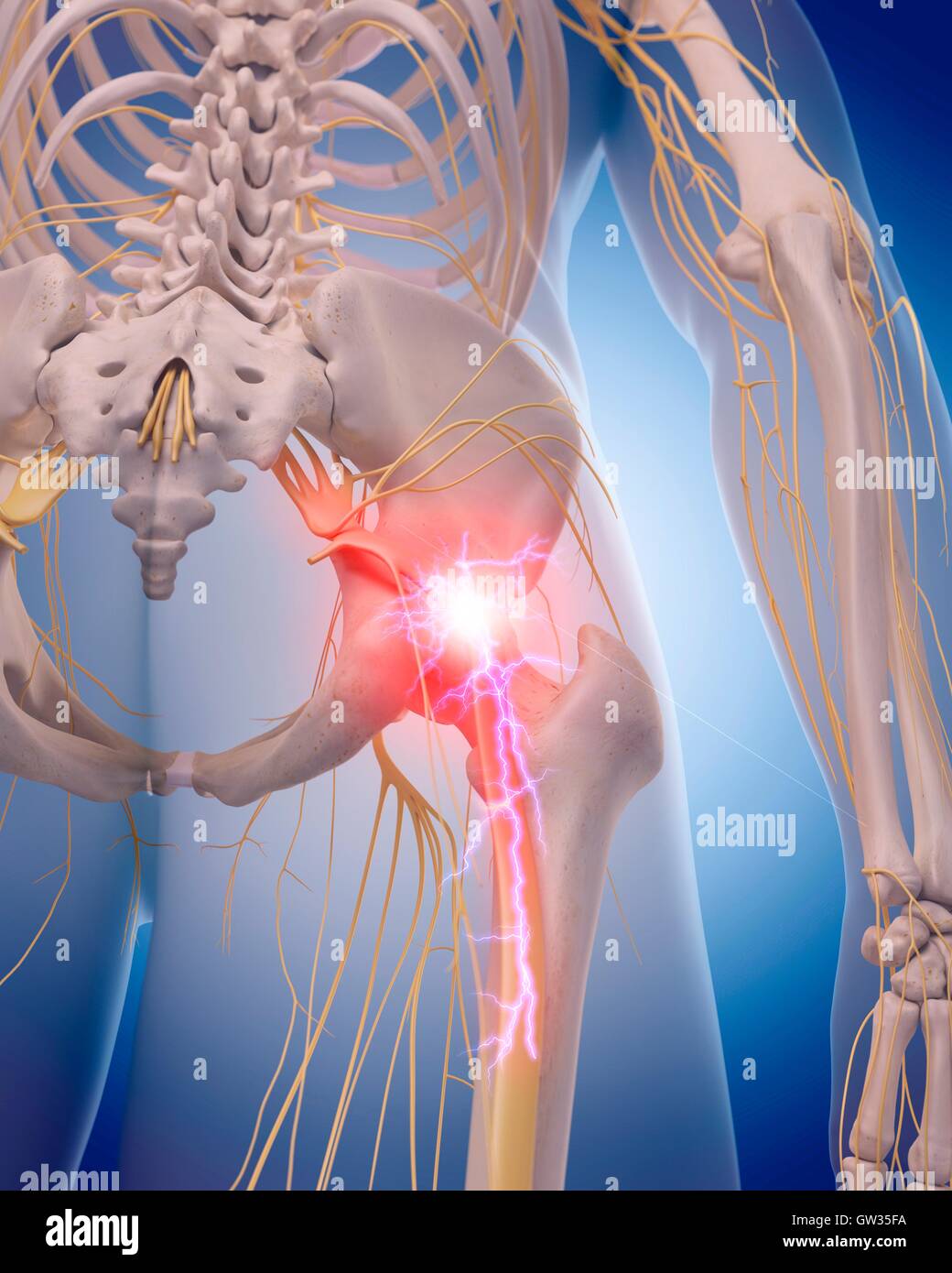 Sciatic nerve pain hi-res stock photography and images - Alamy