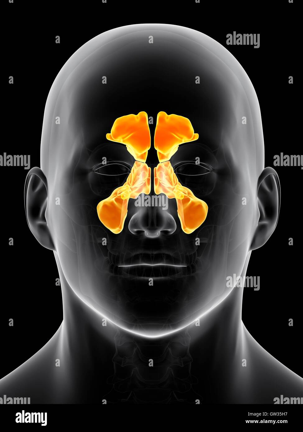 Human sinuses illustration hi-res stock photography and images - Alamy