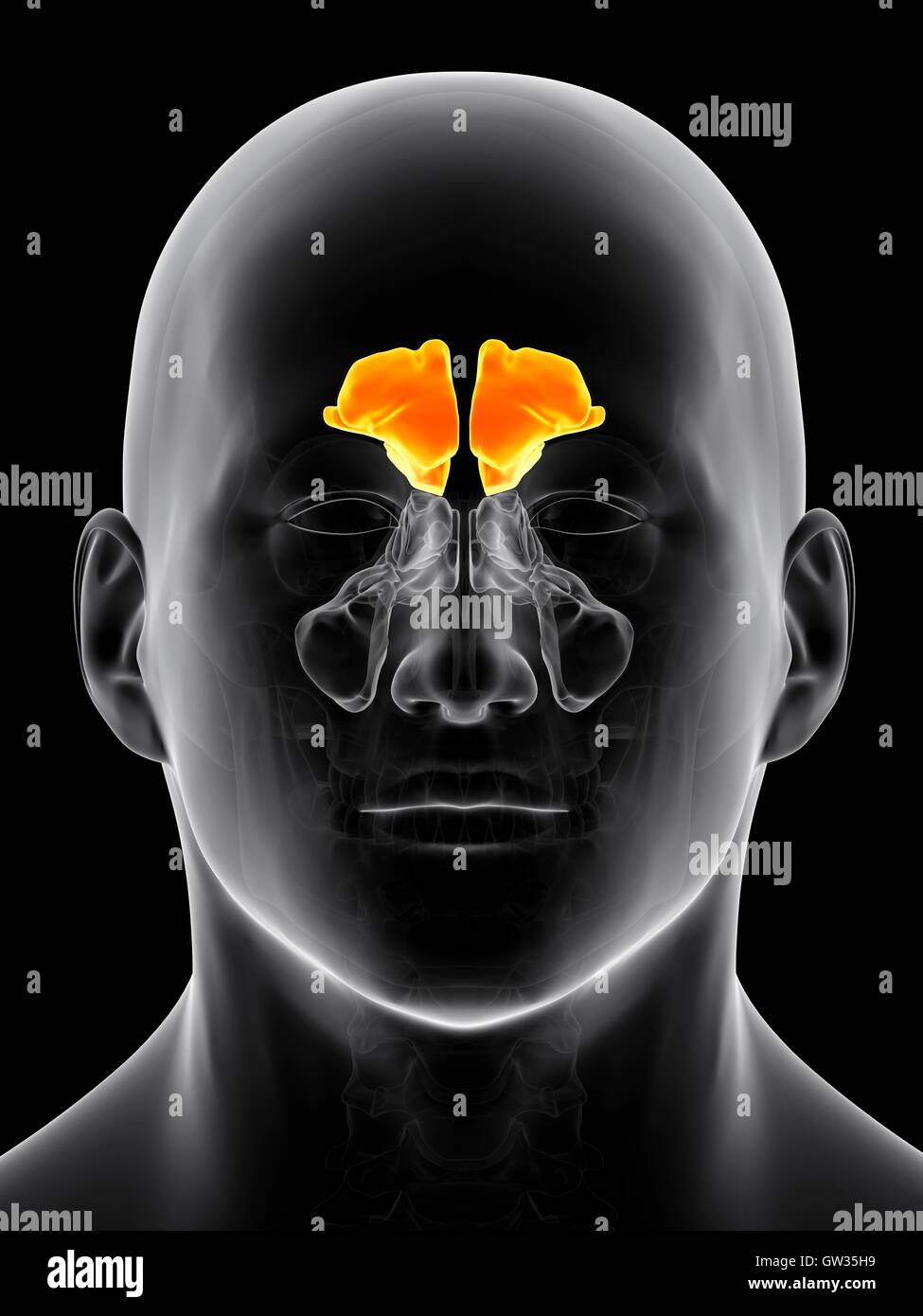 Human sinuses, illustration Stock Photo - Alamy