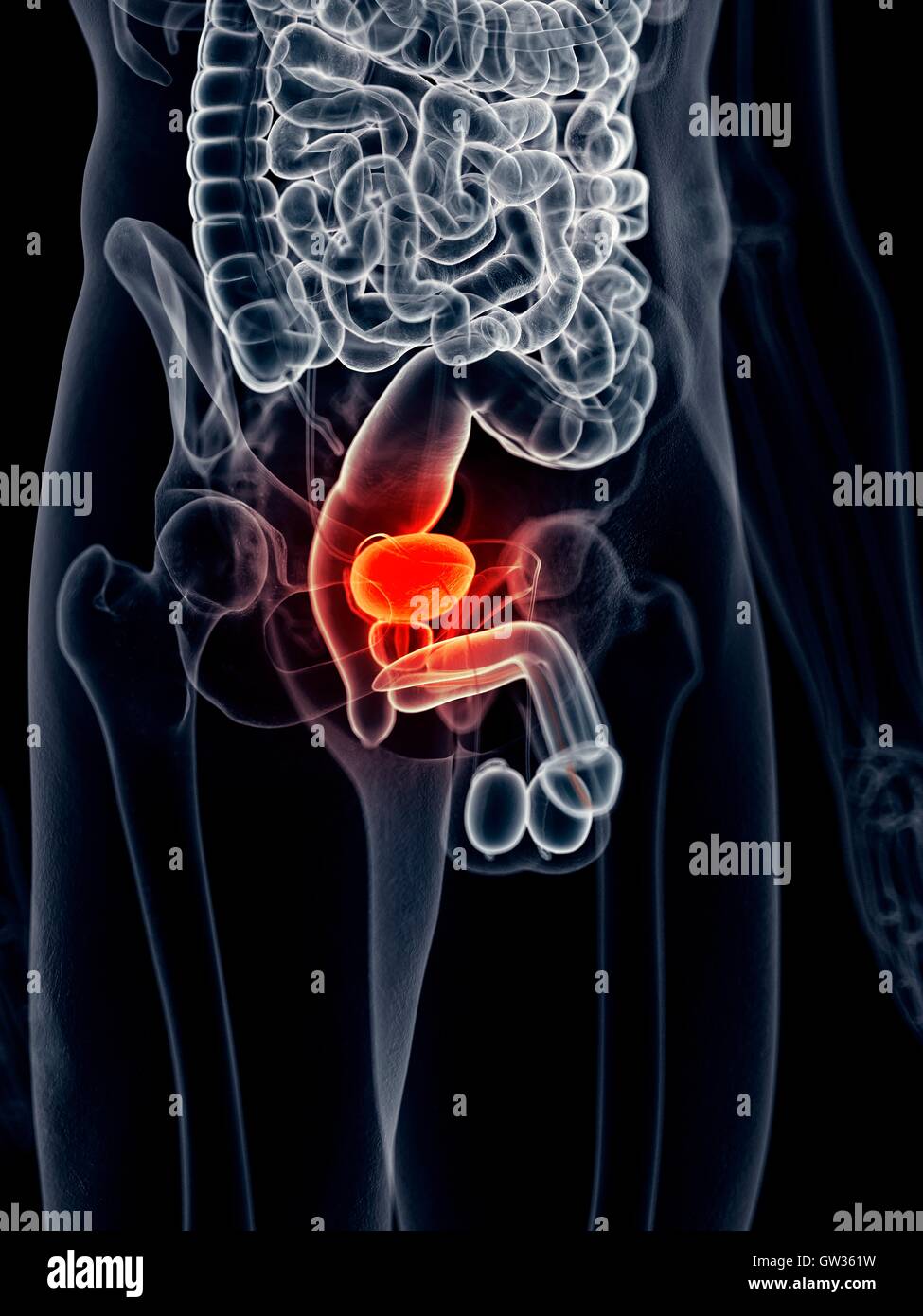 Abnormal urinary bladder hi-res stock photography and images - Alamy