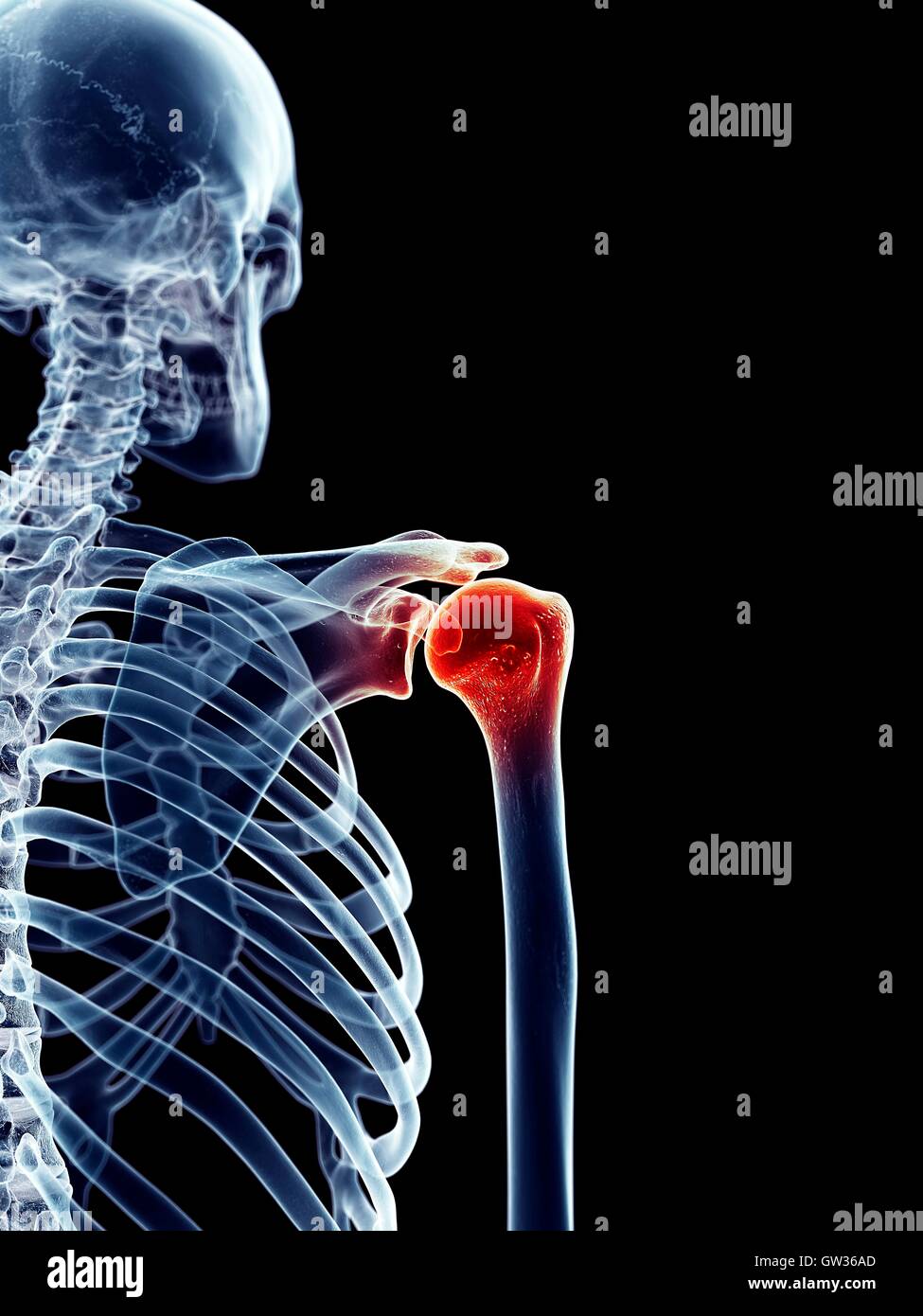 Human shoulder pain, illustration Stock Photo - Alamy
