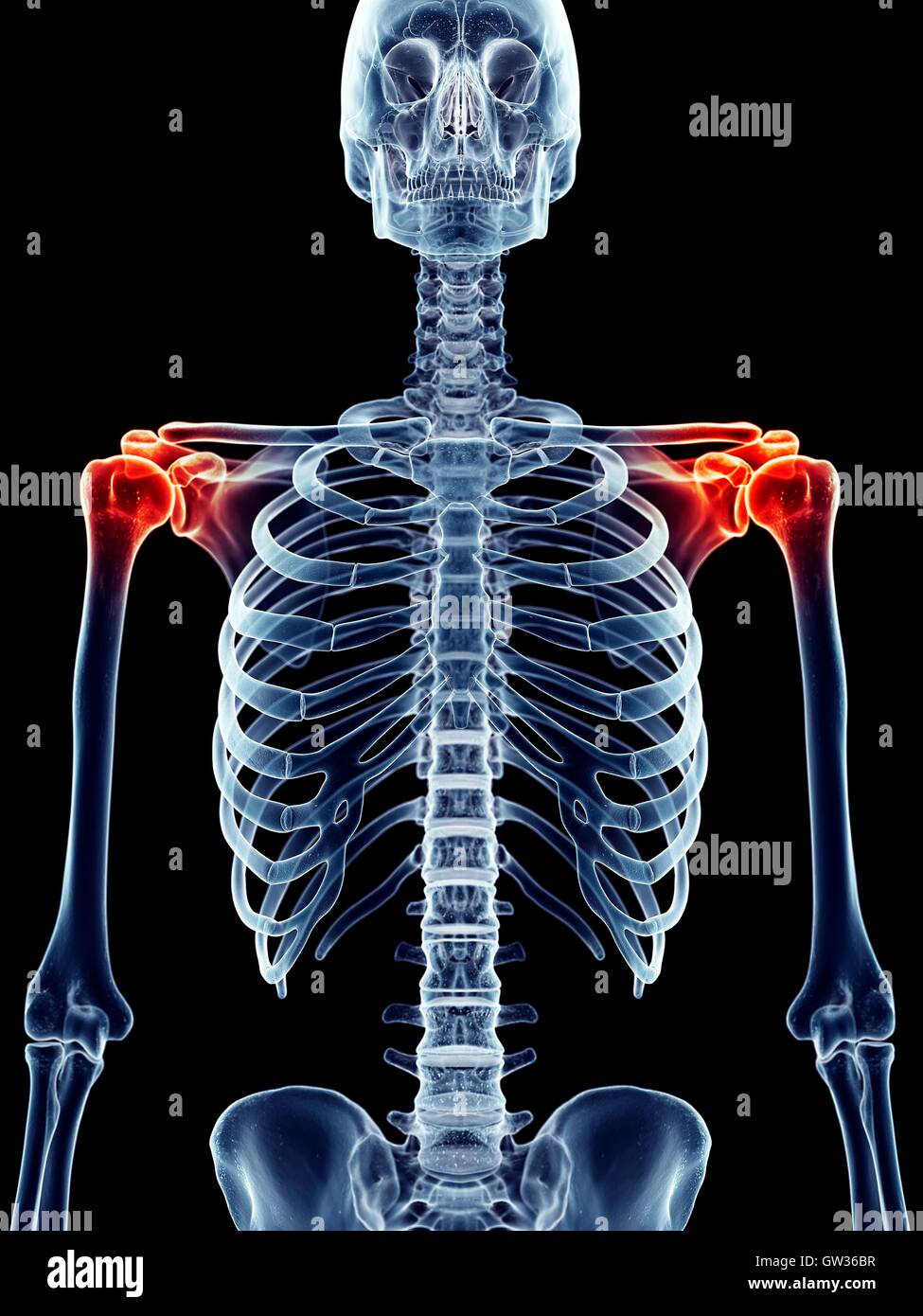 Human shoulder pain, illustration Stock Photo - Alamy