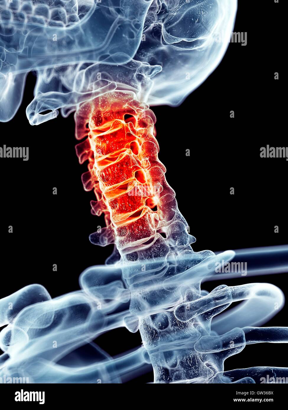 Cervical spine pain hi-res stock photography and images - Alamy