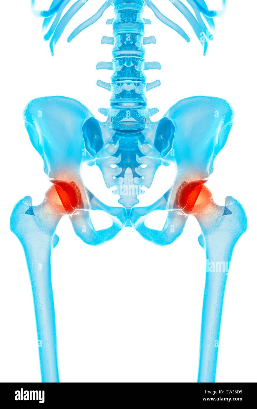 Human hip pain, illustration Stock Photo - Alamy