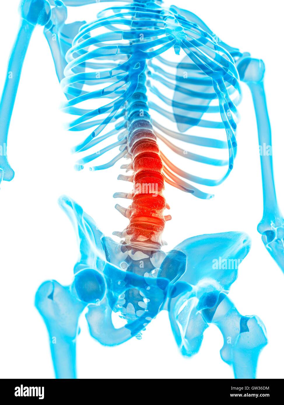 Human spinal pain, illustration Stock Photo - Alamy