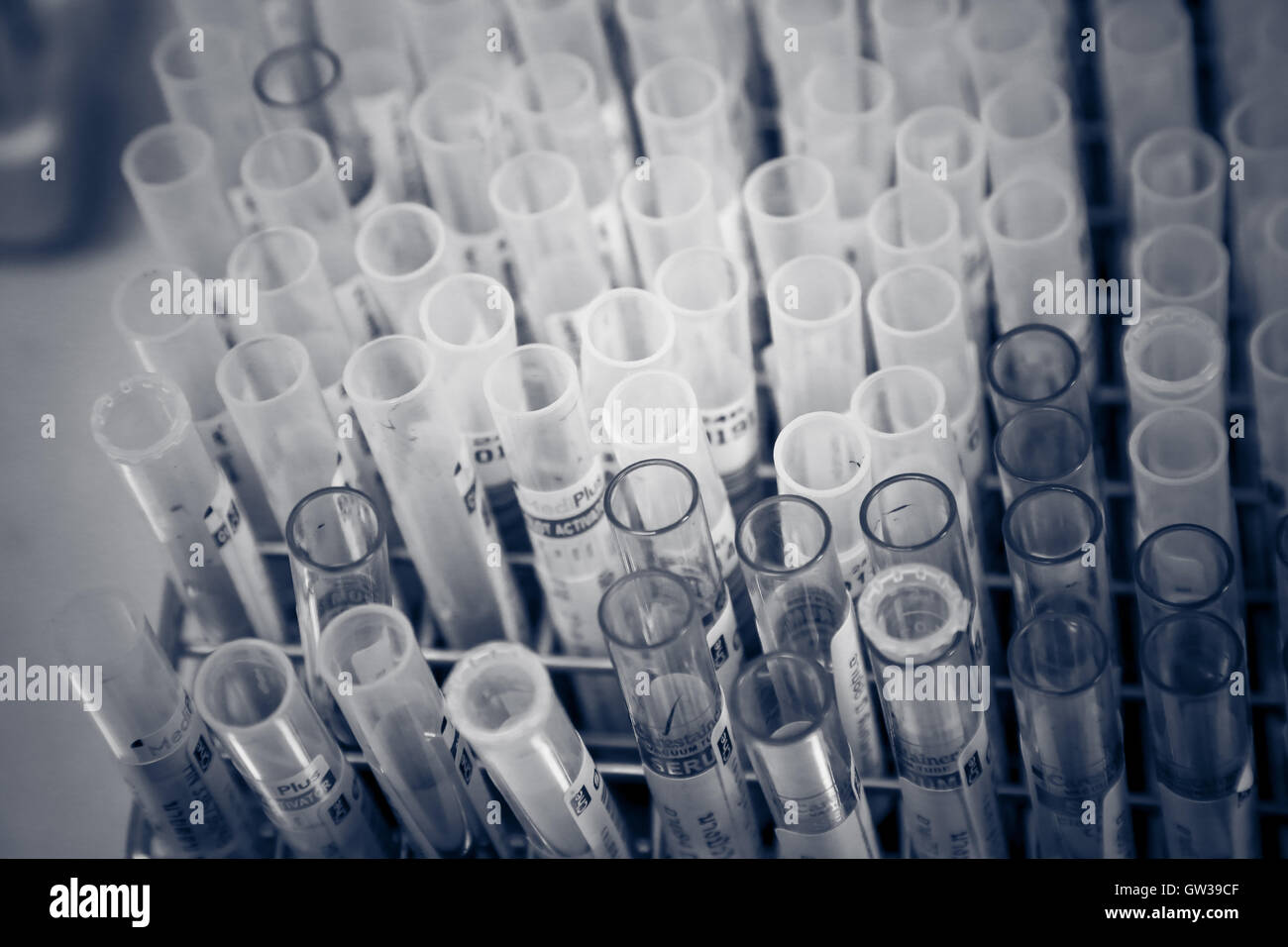 top view tubes prepared for centrifuge machine in hematology laboratory ...