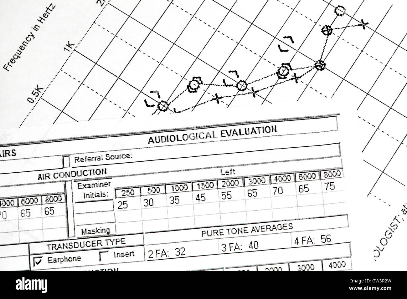 A hearing test graph with the evaluation form Stock Photo - Alamy