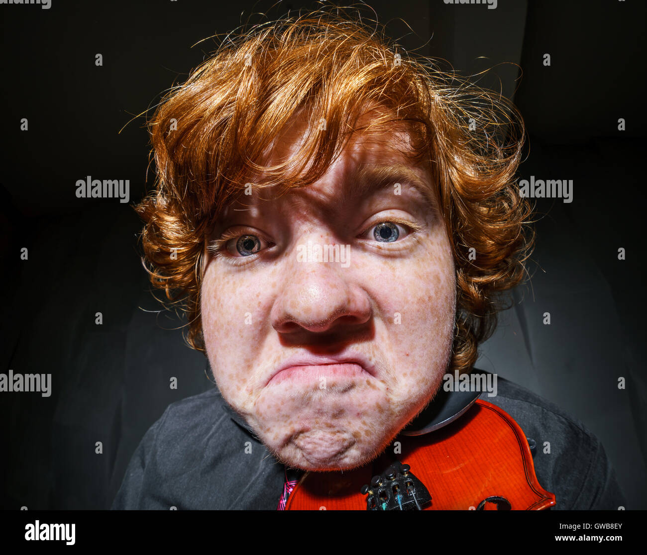 Disfigured boy hi-res stock photography and images - Alamy