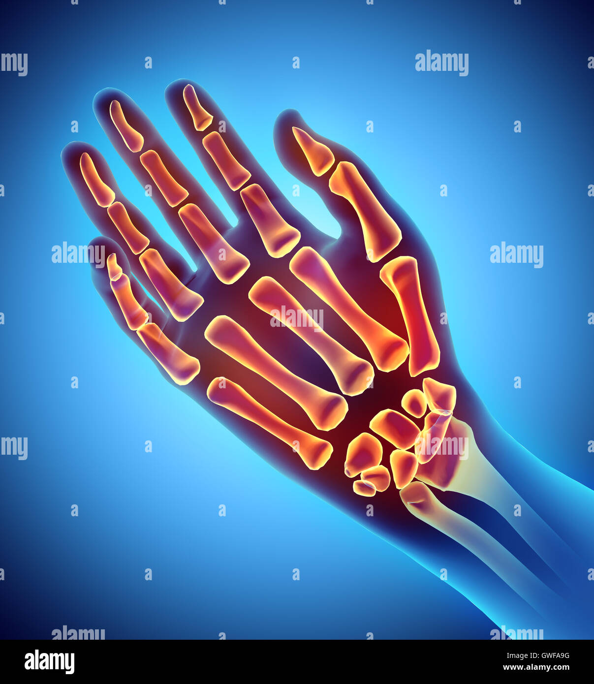 3D illustration of Hand Skeleton - Part of Human Skeleton Stock Photo ...
