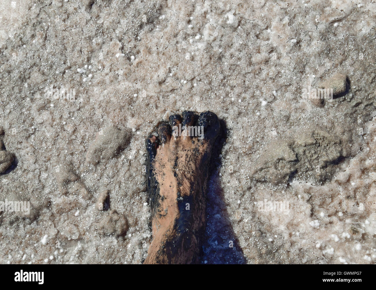 Human foot in the mud and salt lake brine. Therapeutic mud and salt ...