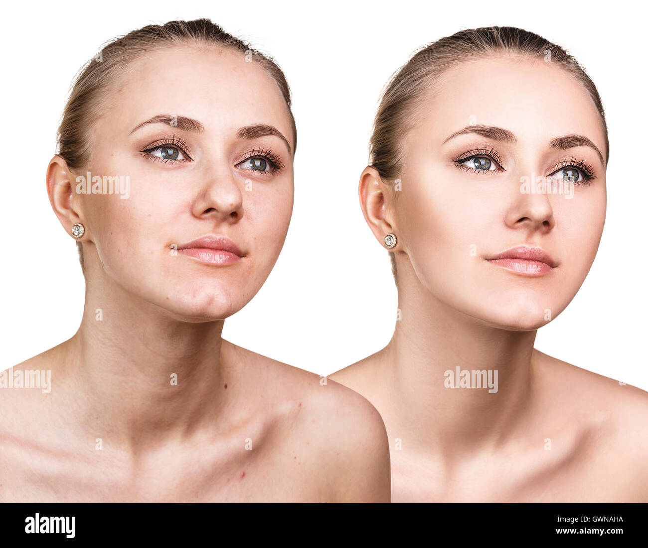 Face with problem hi-res stock photography and images - Alamy