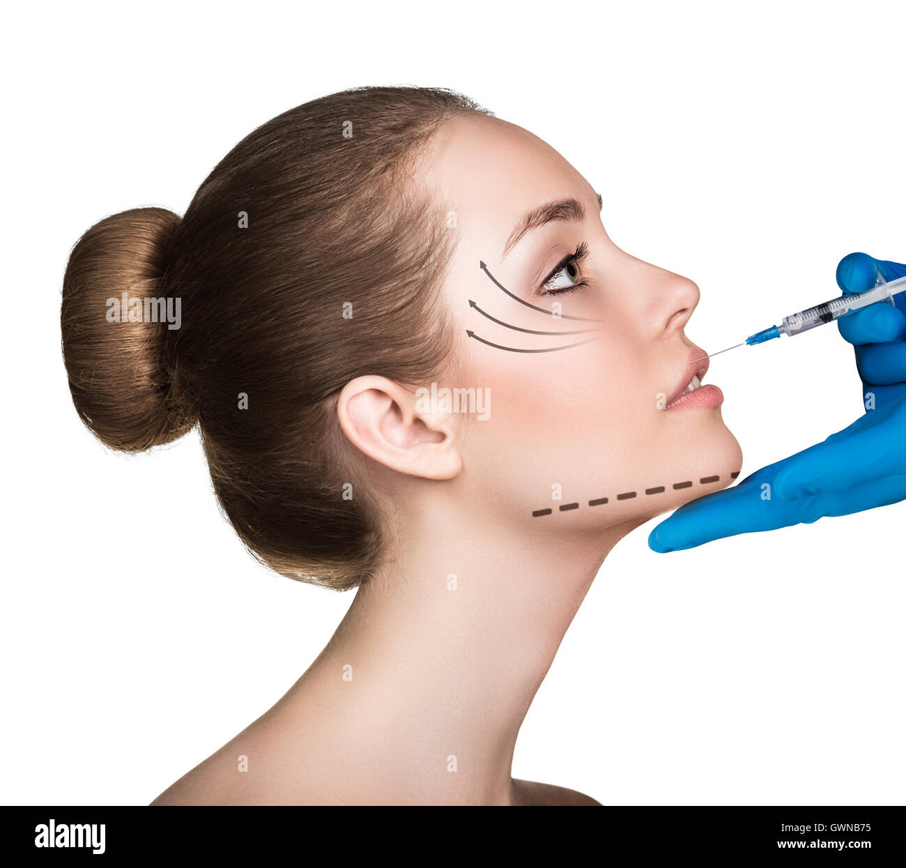 Human injection hi-res stock photography and images - Alamy