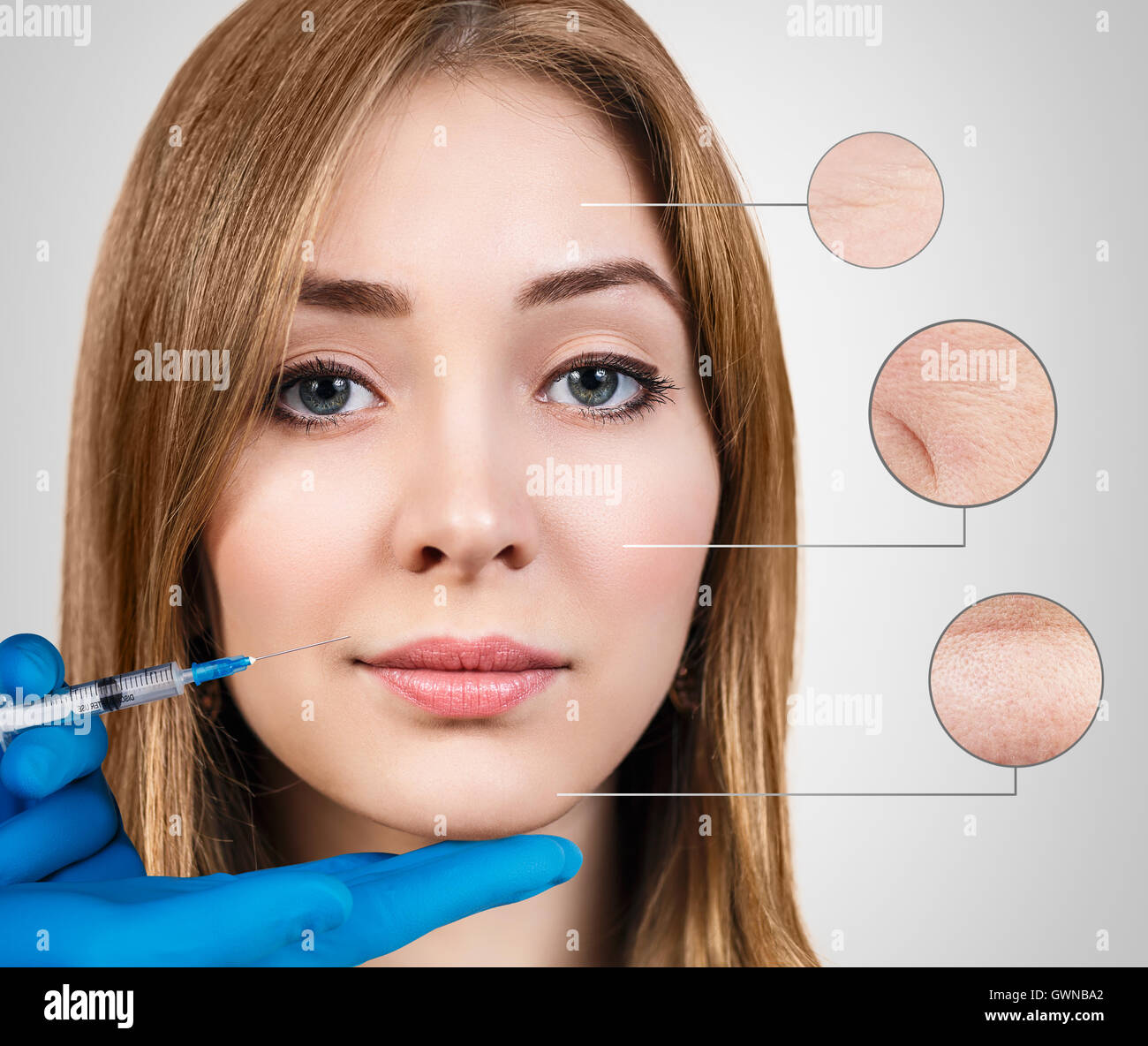 Cosmetic injection to the pretty female face Stock Photo - Alamy