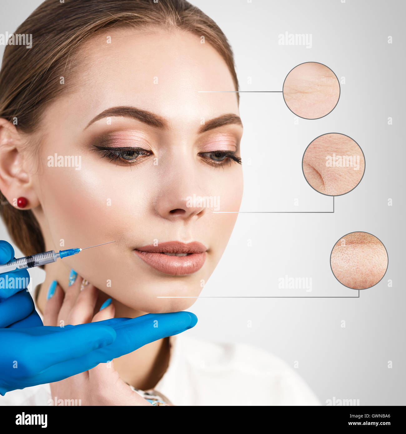 Injection old hi-res stock photography and images - Alamy