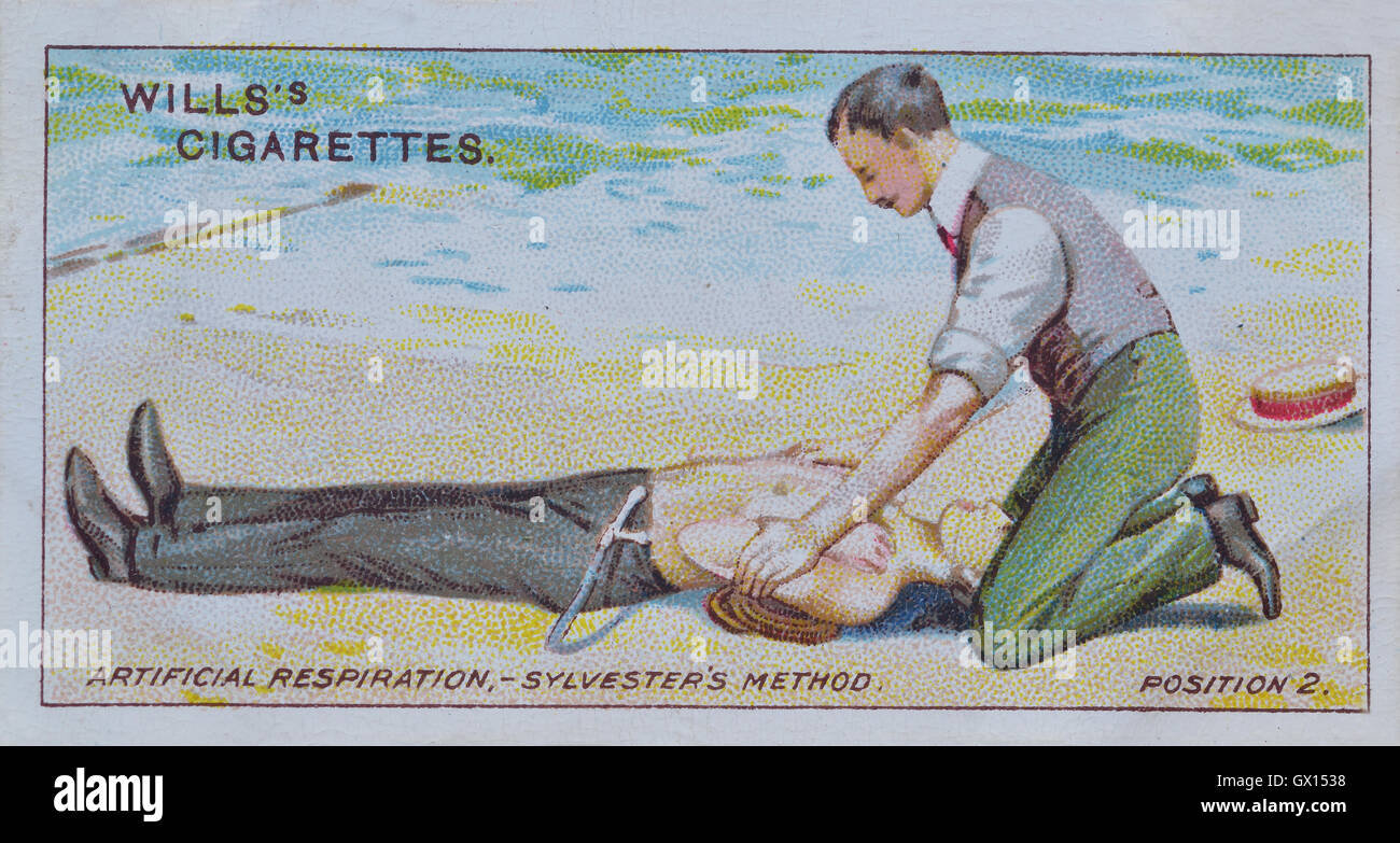 Will's cigarette card of artificial respiration. The Sylvester's method ...