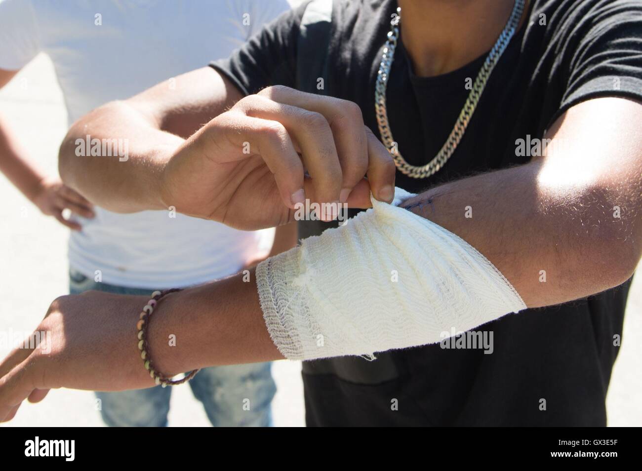 Knife wound hi-res stock photography and images - Alamy