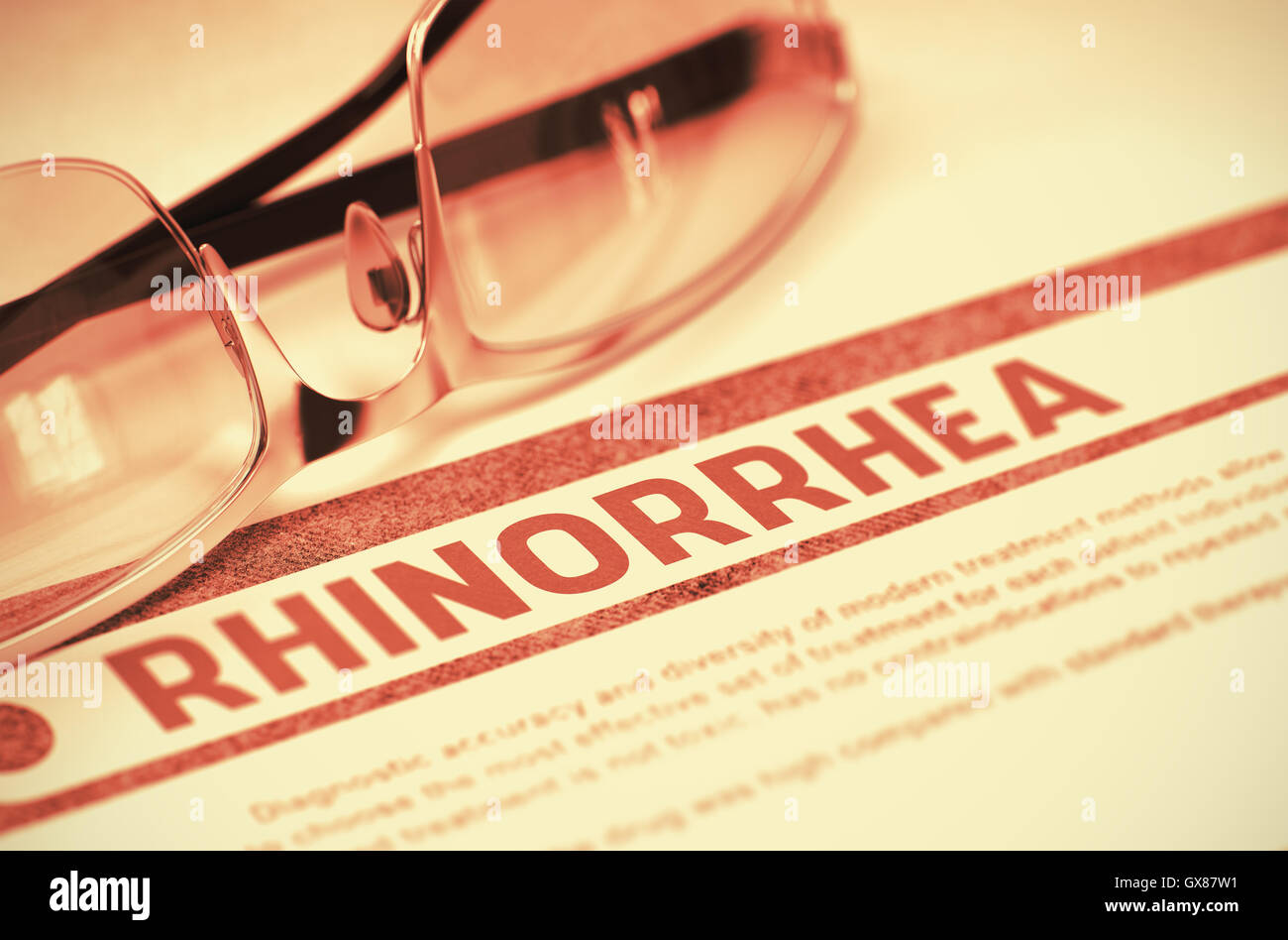 Rhinorrhea hi-res stock photography and images - Alamy
