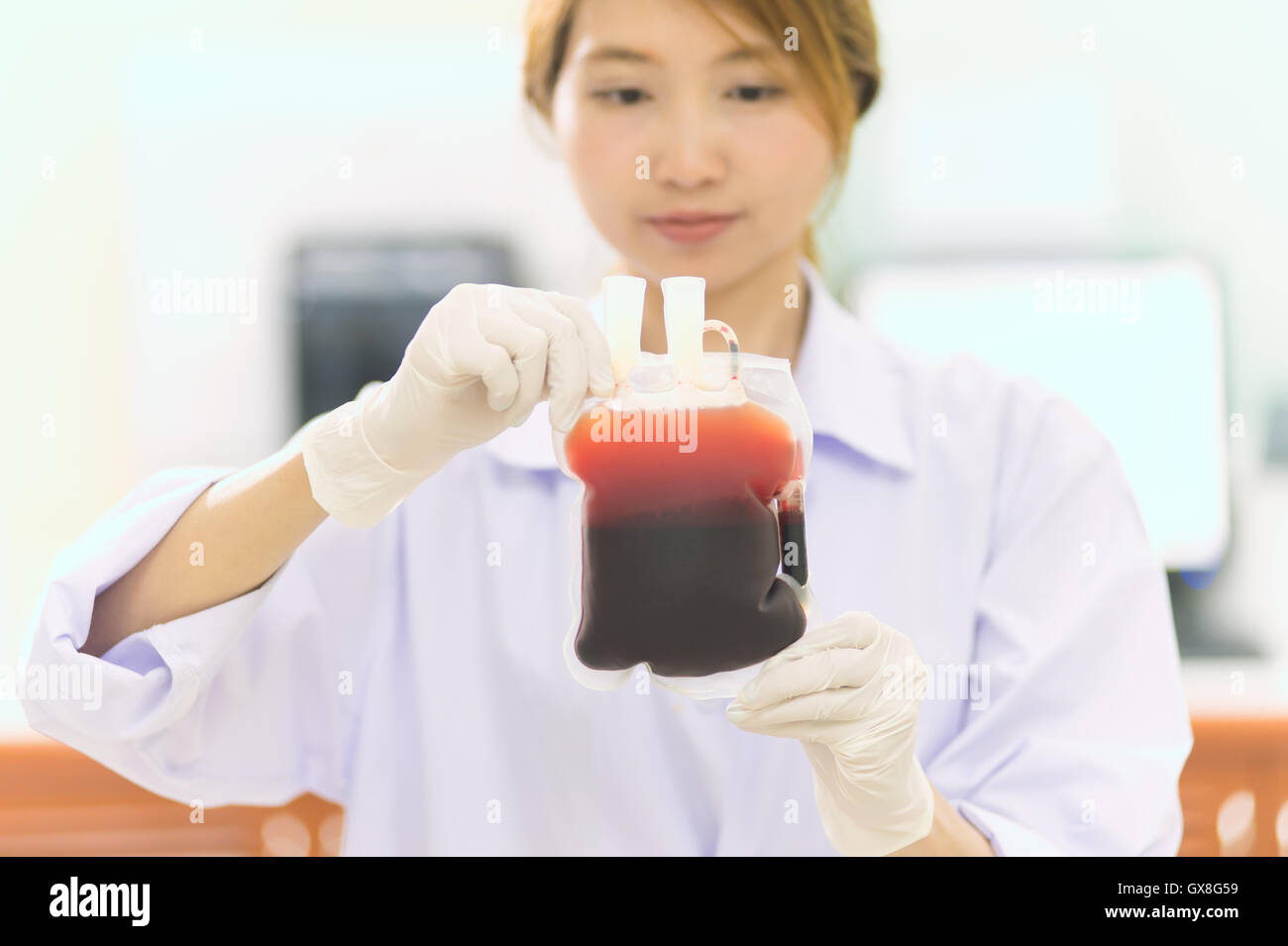 Bag of Blood in hand asian woman Doctor Stock Photo - Alamy
