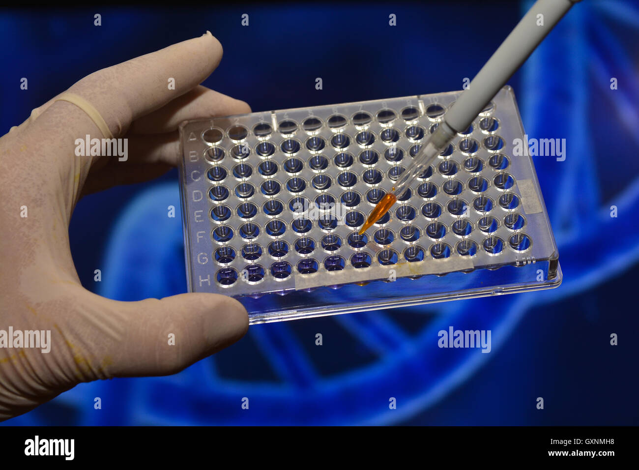Tests in Medical Science Laboratory. DNA testing for the diagnosis of ...