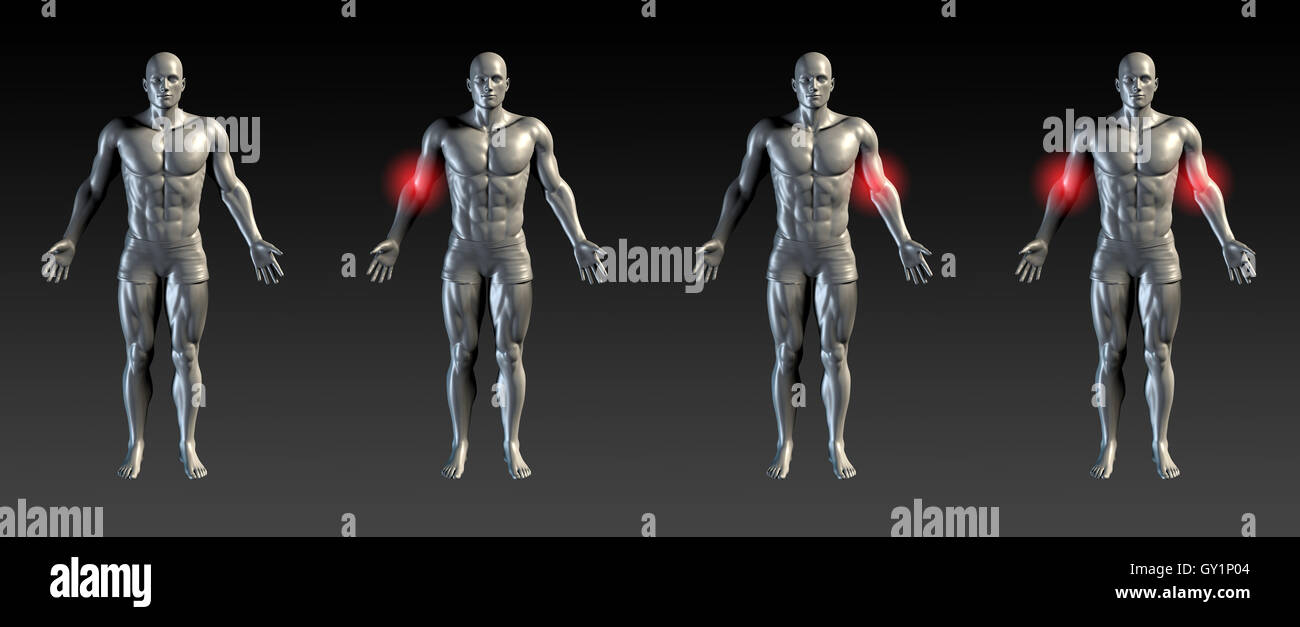 Elbows Injury with Red Glow on Area Series Stock Photo - Alamy