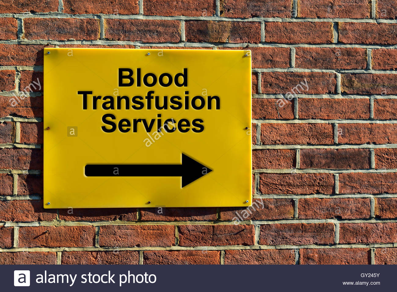 Unit Blood Transfusion Stock Photos & Unit Blood Transfusion Stock ...