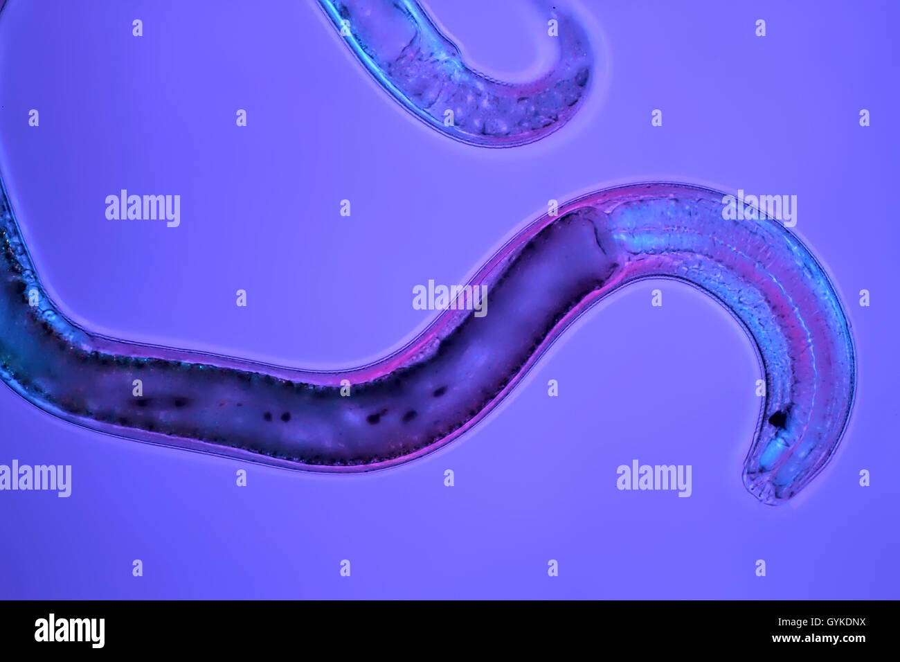 Nematoda Wuchereria Phylum Aschelminthes (Nematoda) Biology For