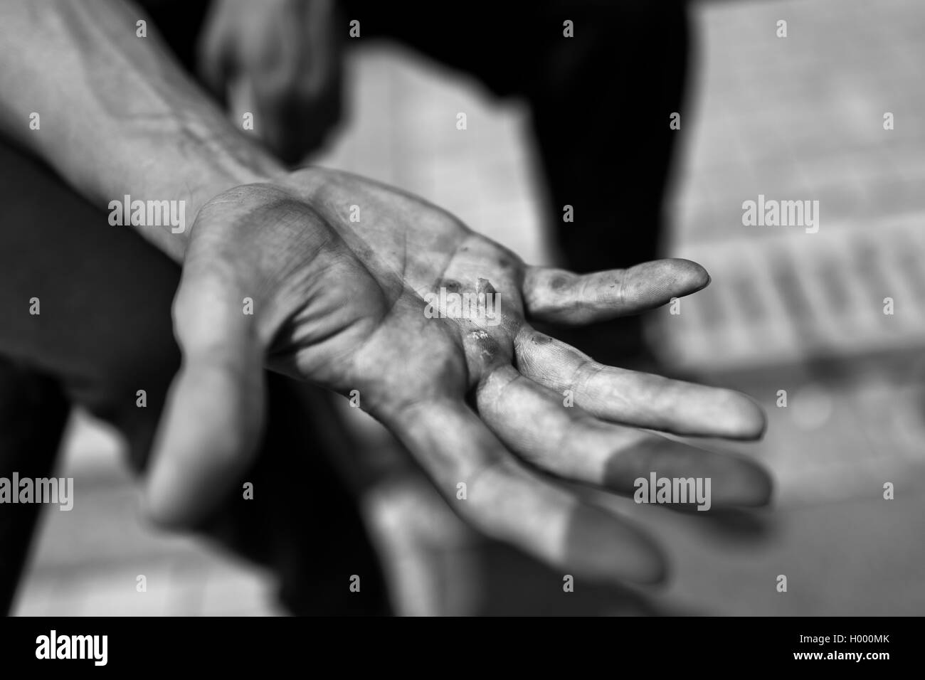 Logan Franco, a parkour runner from Tamashikaze team, shows blisters ...